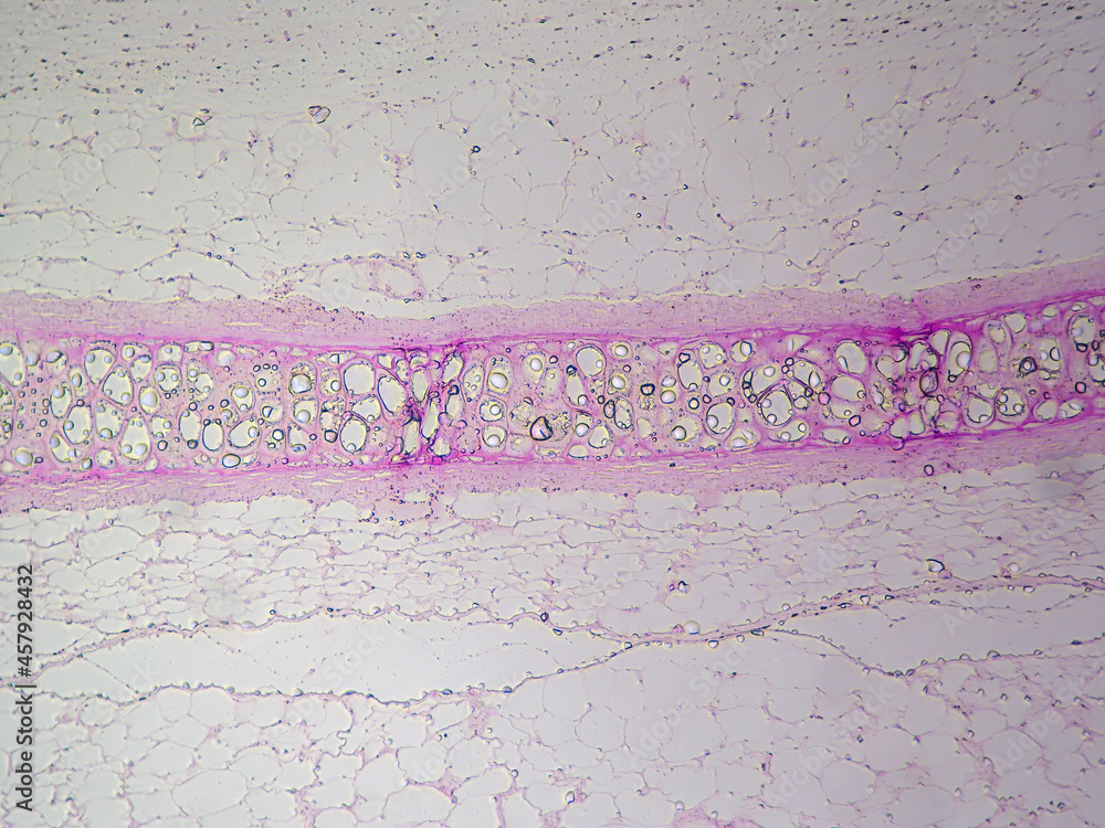 Histology image showing hyaline cartilage, perichondrium, and surround ...