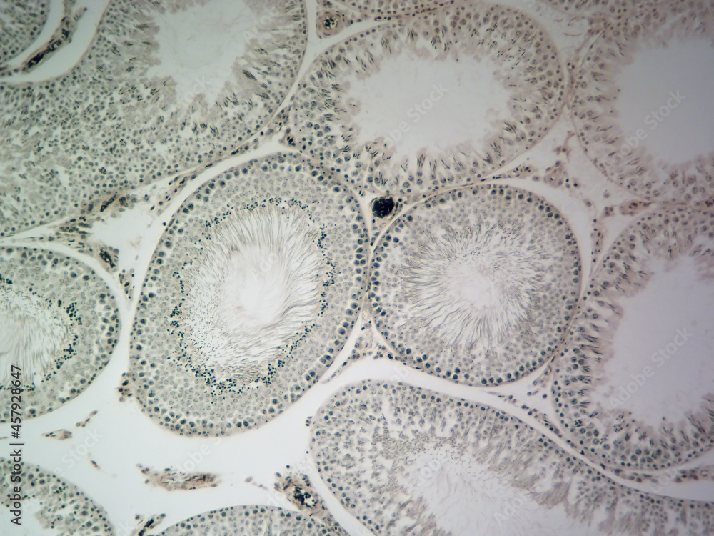 Histology image of spermatogenesis in rat testis showing sperm ...