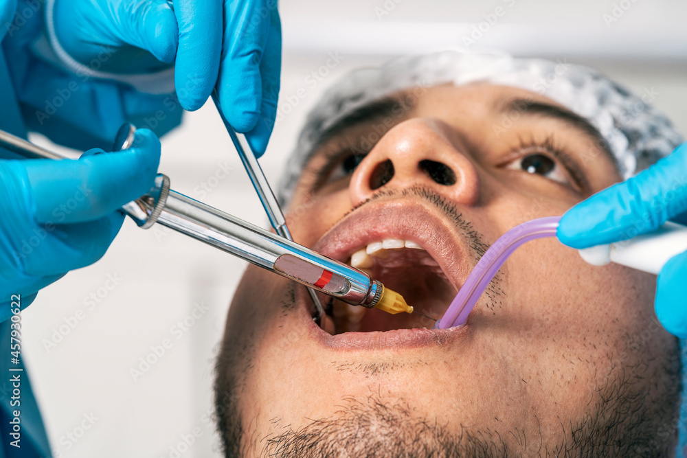 dentist's hands injecting anaesthesia into a patient's mouth in a ...