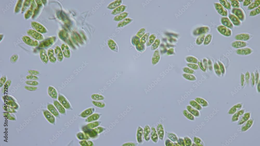 Natural cleaning of water bodies with the help of microorganisms. Unicellular algae and plants ...