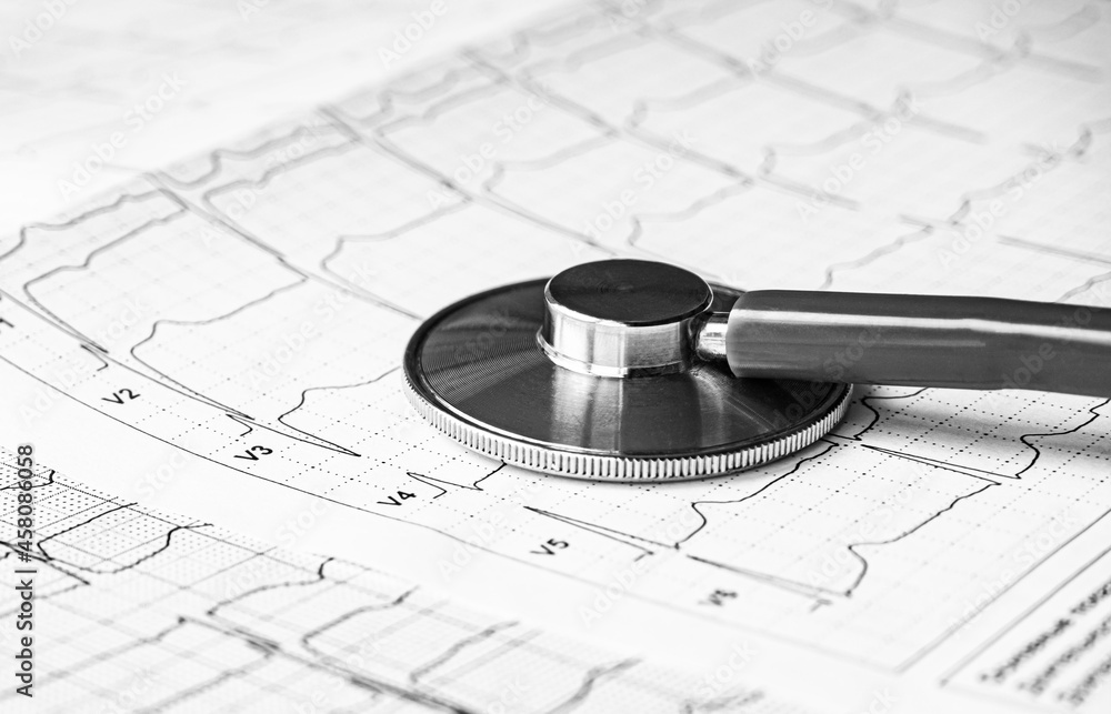 Stethoscope on the electrocardiogram (ECG) graph (top view). EKG ...