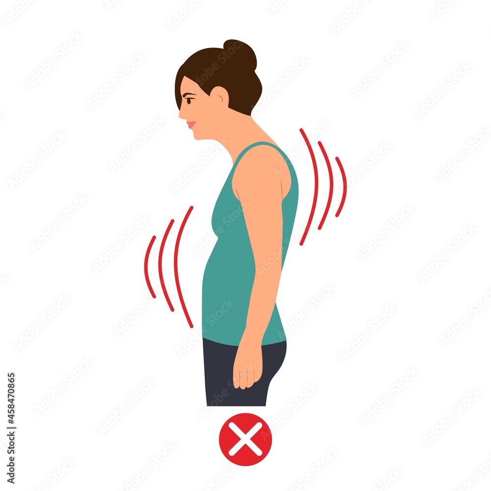 Incorrect standing posture.Young woman with bad posture. Cervical ...