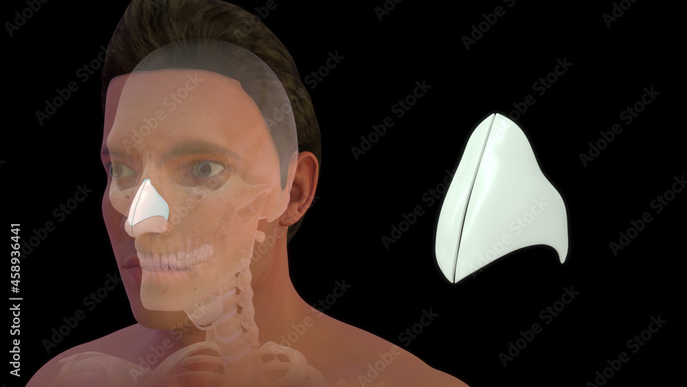 The lateral cartilage (upper lateral cartilage, lateral process of ...