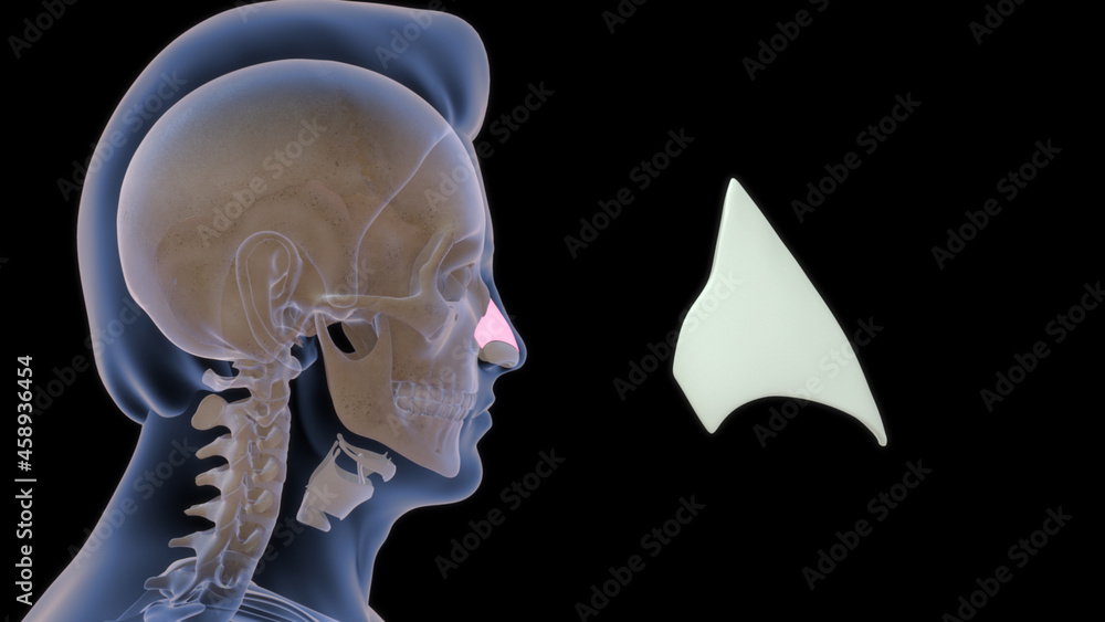 The lateral cartilage (upper lateral cartilage, lateral process of ...