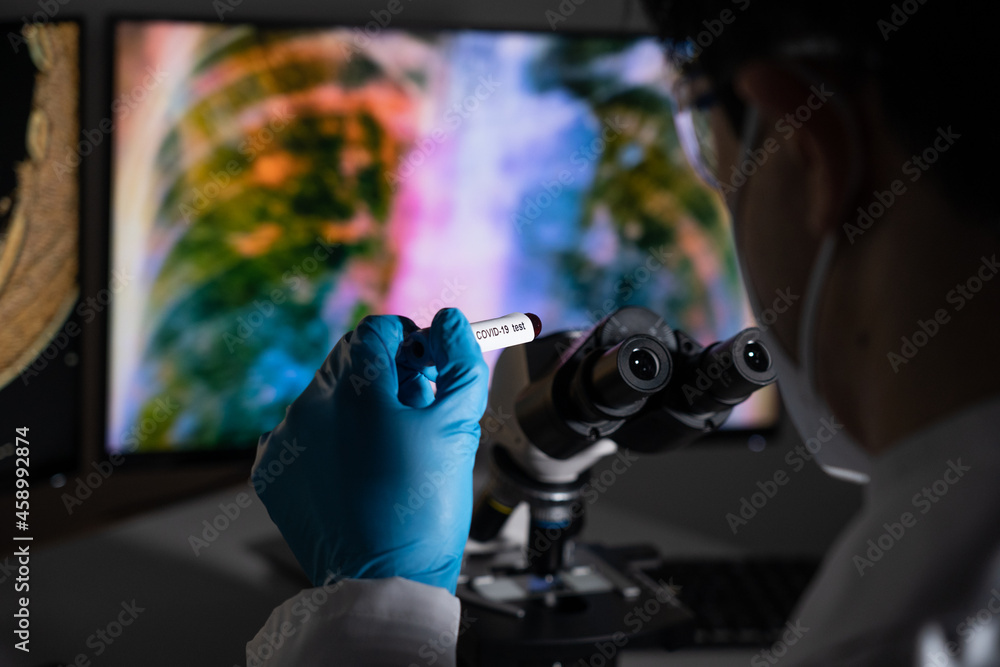 Blood tests for Covid-19 screening and X-ray or ct images of infected ...