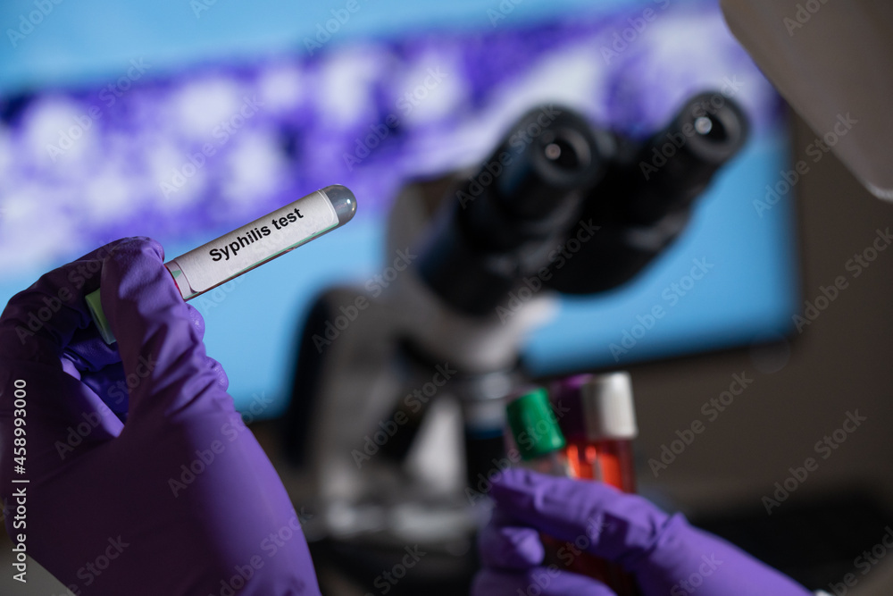 Blood test for syphilis caused by the bacterium treponema pallidum or ...