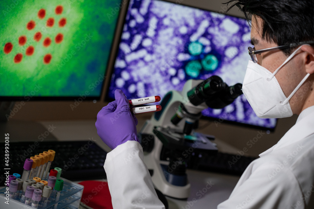 Blood tests for hepatitis b (HBC) and c (HCV). Stock Photo | Adobe Stock