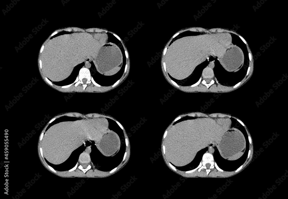 Ct scan and MRI chest unique professional images Stock Photo | Adobe Stock