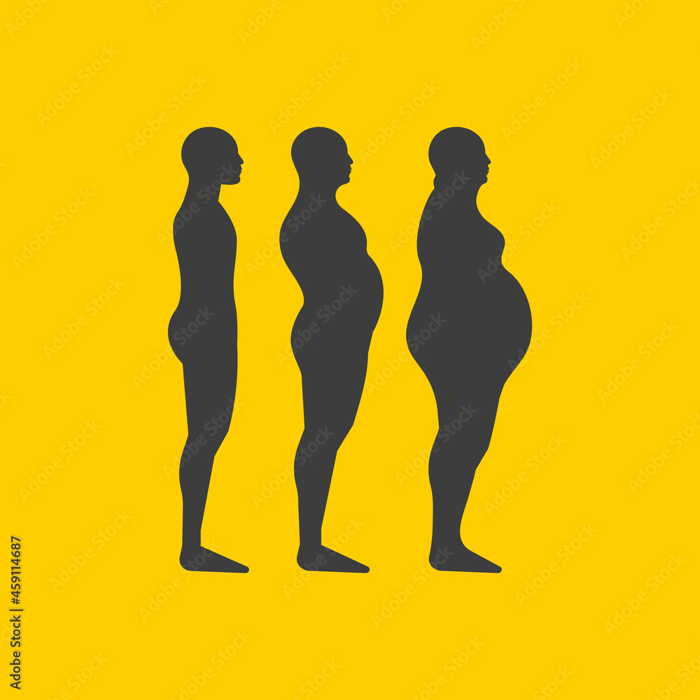 Stages of obesity of man. Silhouettes of person with different age from ...