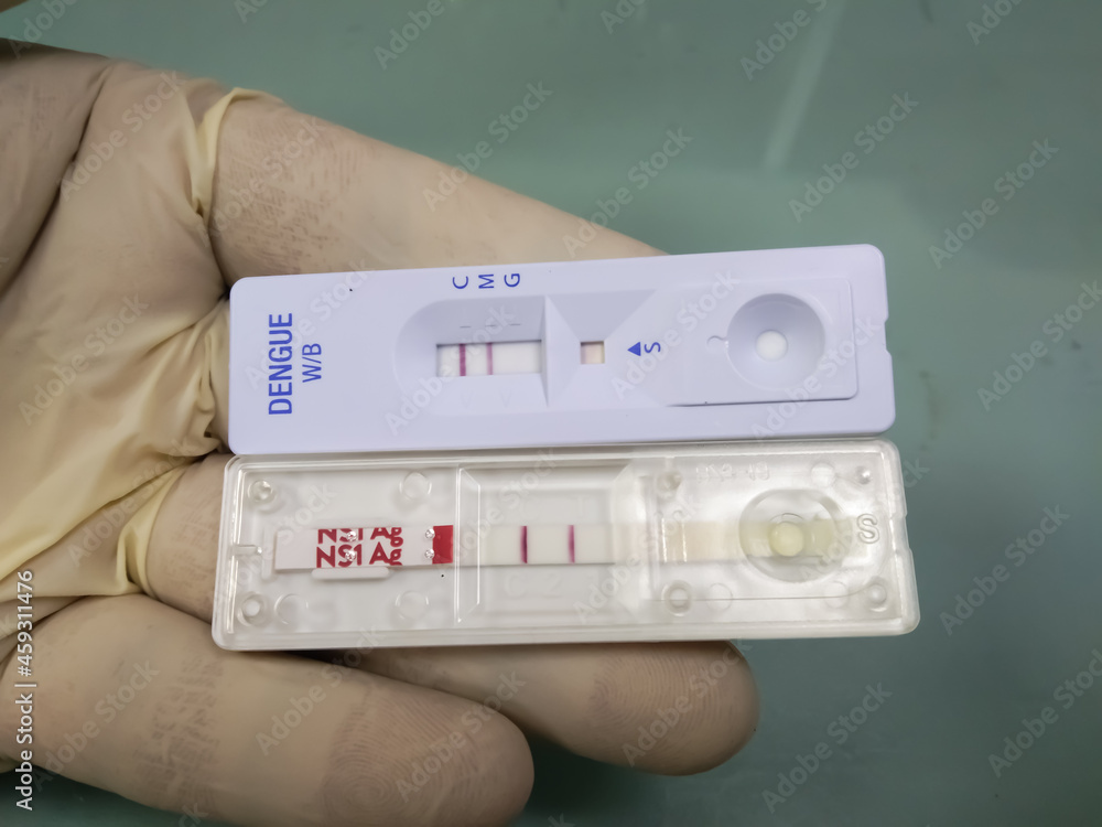 Blood tube and Rapid test kit for Dengue antigen NS1Ag and antibody IgG ...