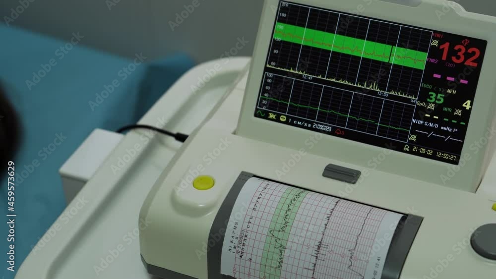 Electronic Cardiotocography Machine Monitoring Fetal Heart Contractions ...