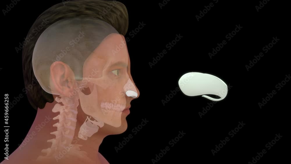 The major alar cartilage (greater alar cartilage) (lower lateral ...