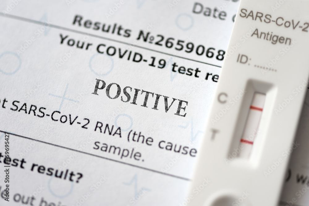 Laboratory report with positive test result by using rapid test device ...