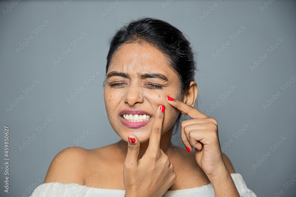 Indian Young lady squeezing her pimples, removing pimple from her face ...