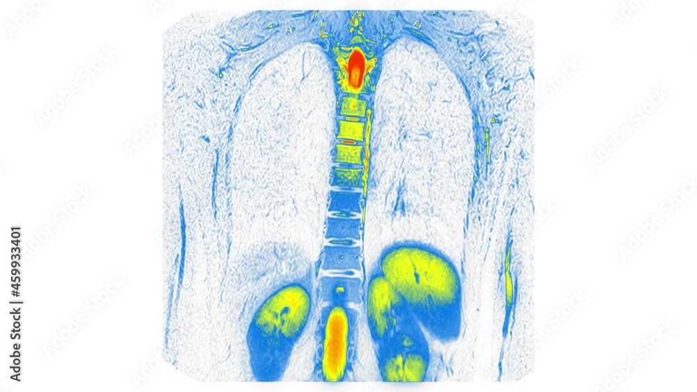 Computed medical tomography MRI upscaled scan of healthy young female ...