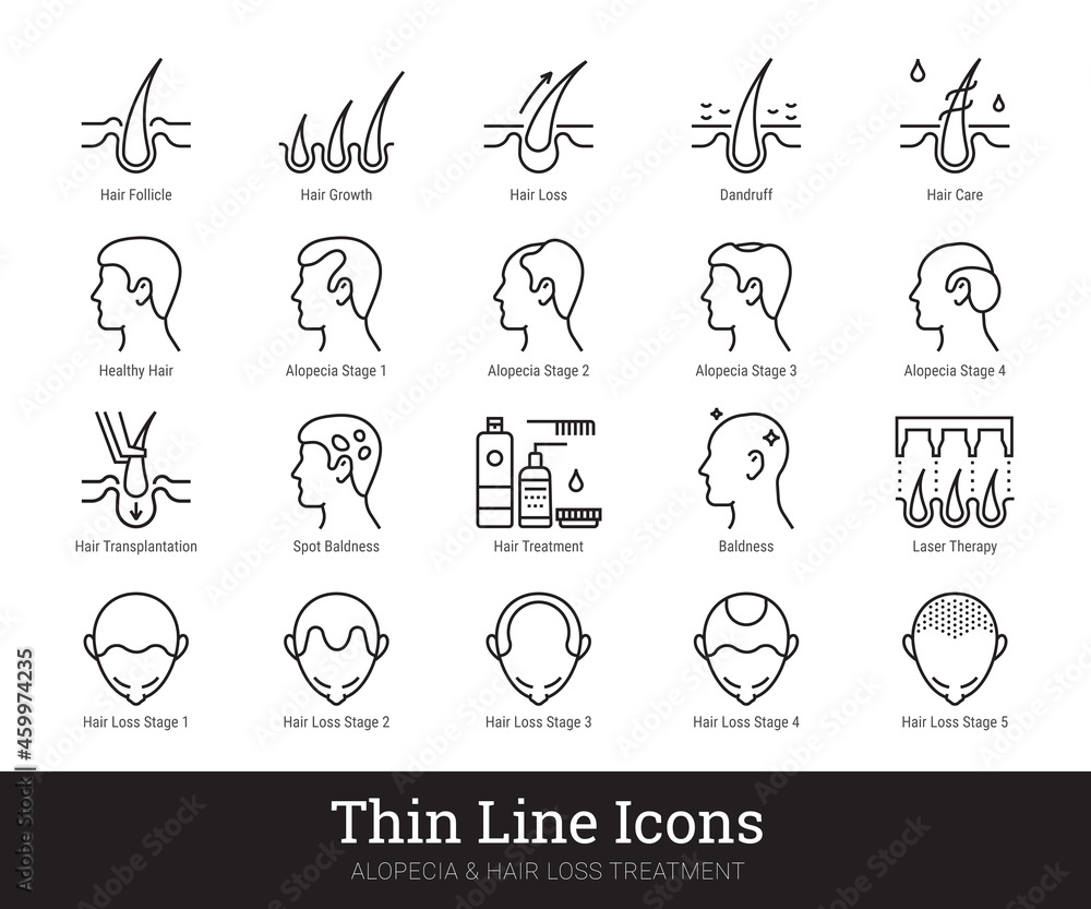 Alopecia, hair loss treatment thin line icons. Vector linear pictograms ...