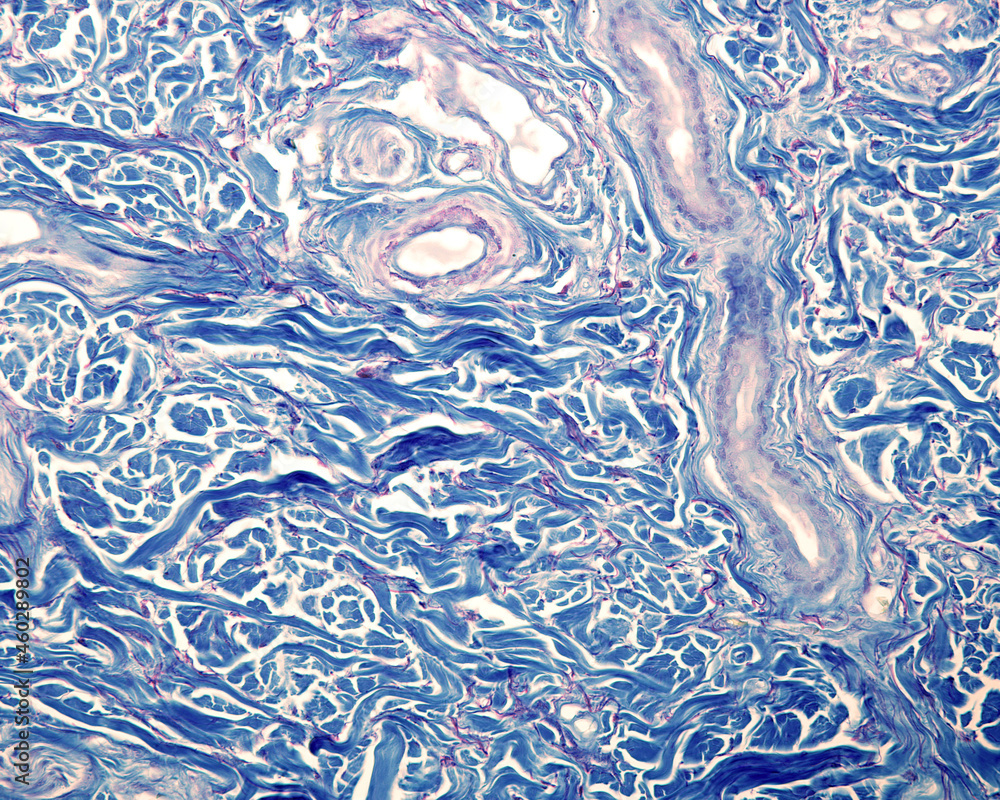 Thick skin dermis. Dermis reticular of the thick skin, stained with the ...
