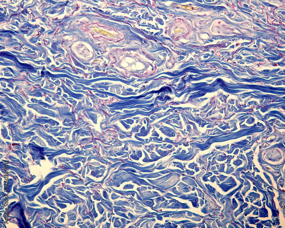 Thick skin dermis. Dermis reticular of the thick skin, stained with the ...
