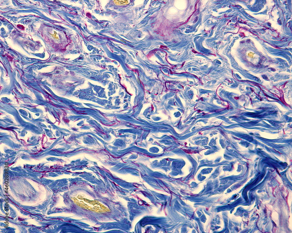 Thick skin dermis. Dermis reticular, stained with the Cajal-Gallego’s ...