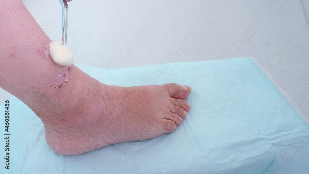 female doctor assistant examines and treats leg woman with scratches ...