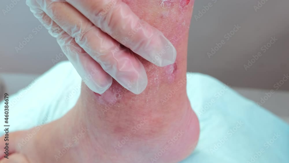 female doctor assistant examines and treats leg woman with scratches ...