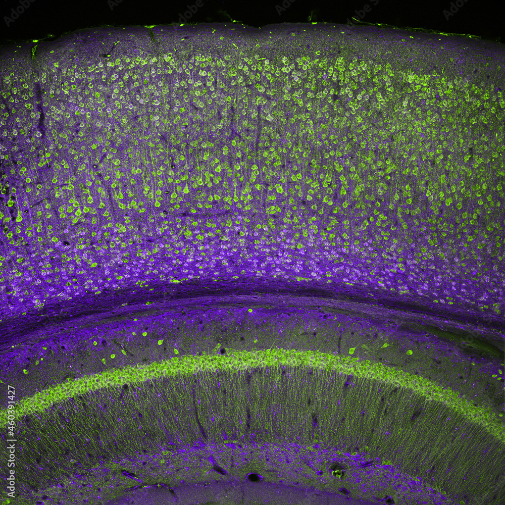 Cerebral cortex and part of the hippocampus under it in a section of a ...