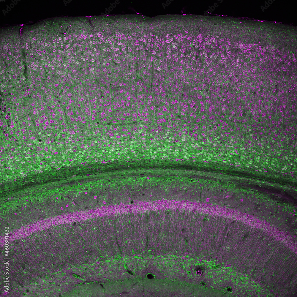 Foto de Cerebral cortex and part of the hippocampus under it in a ...
