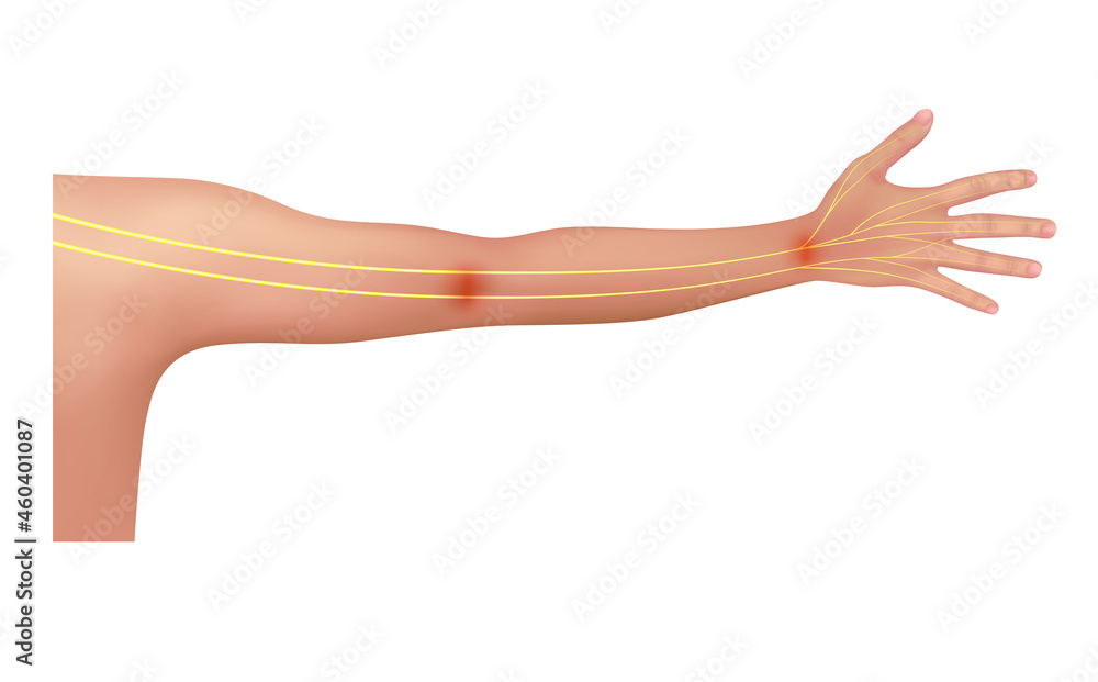 Nerve of the arm about human anatomy yellow. On a white background ...