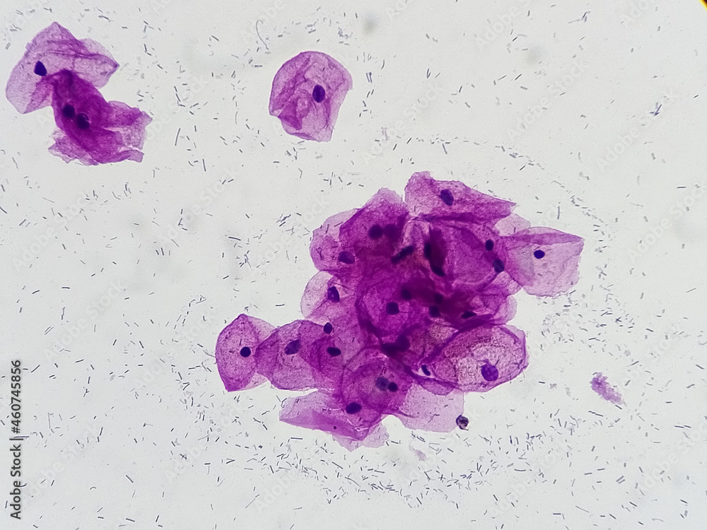 Microscopic view of normal human cervix cells. Squamous epithelial ...