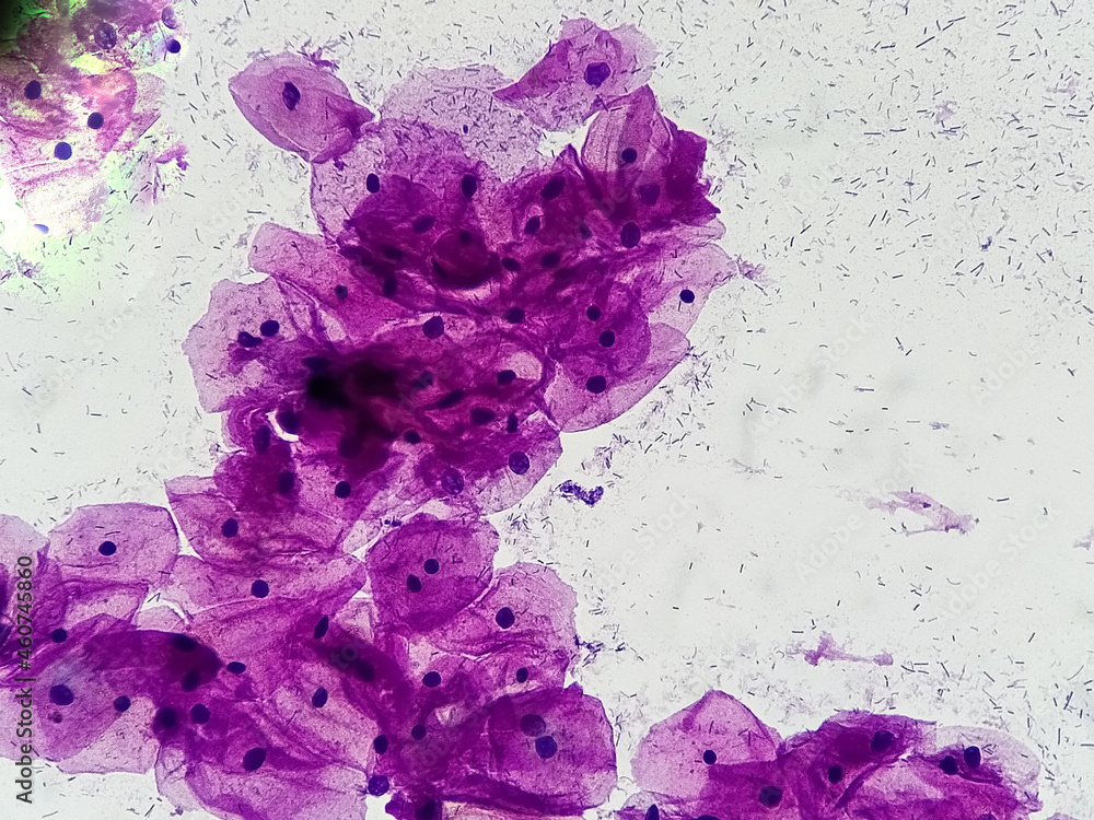 Microscopic view of normal human cervix cells. Squamous epithelial ...