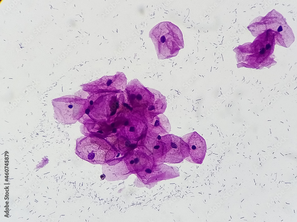Pap's smear Cytology microscopic 100x show normal human cervix cells ...