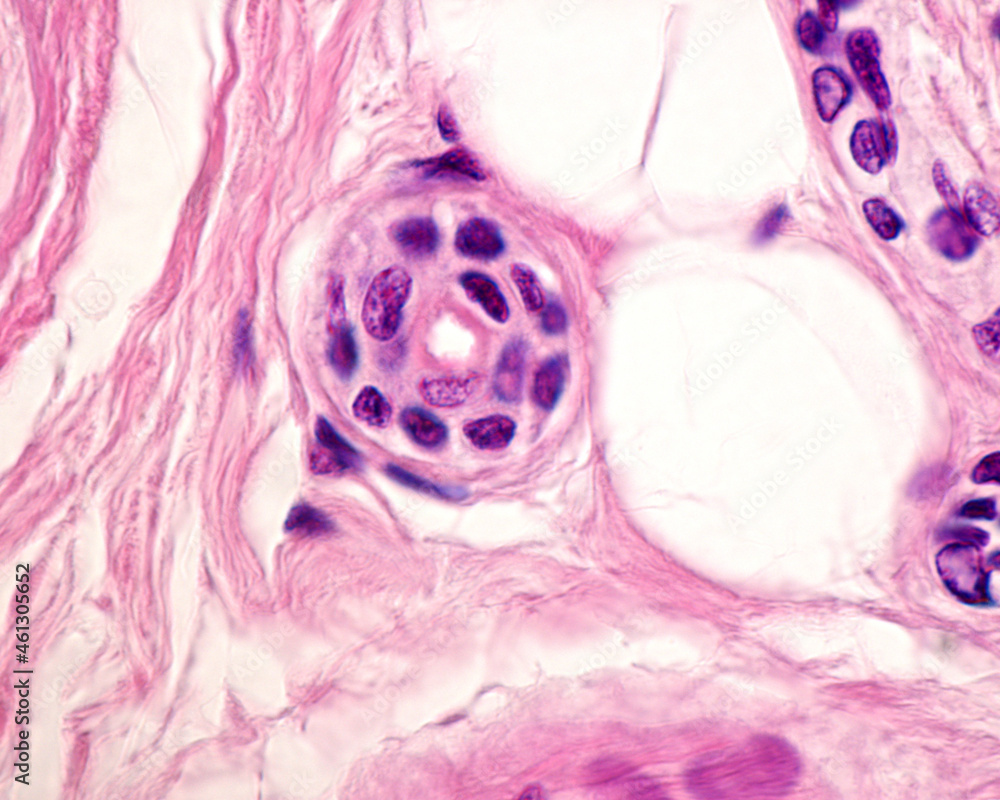 Human eccrine sweat gland. Intradermal excretory duct Stock Photo ...