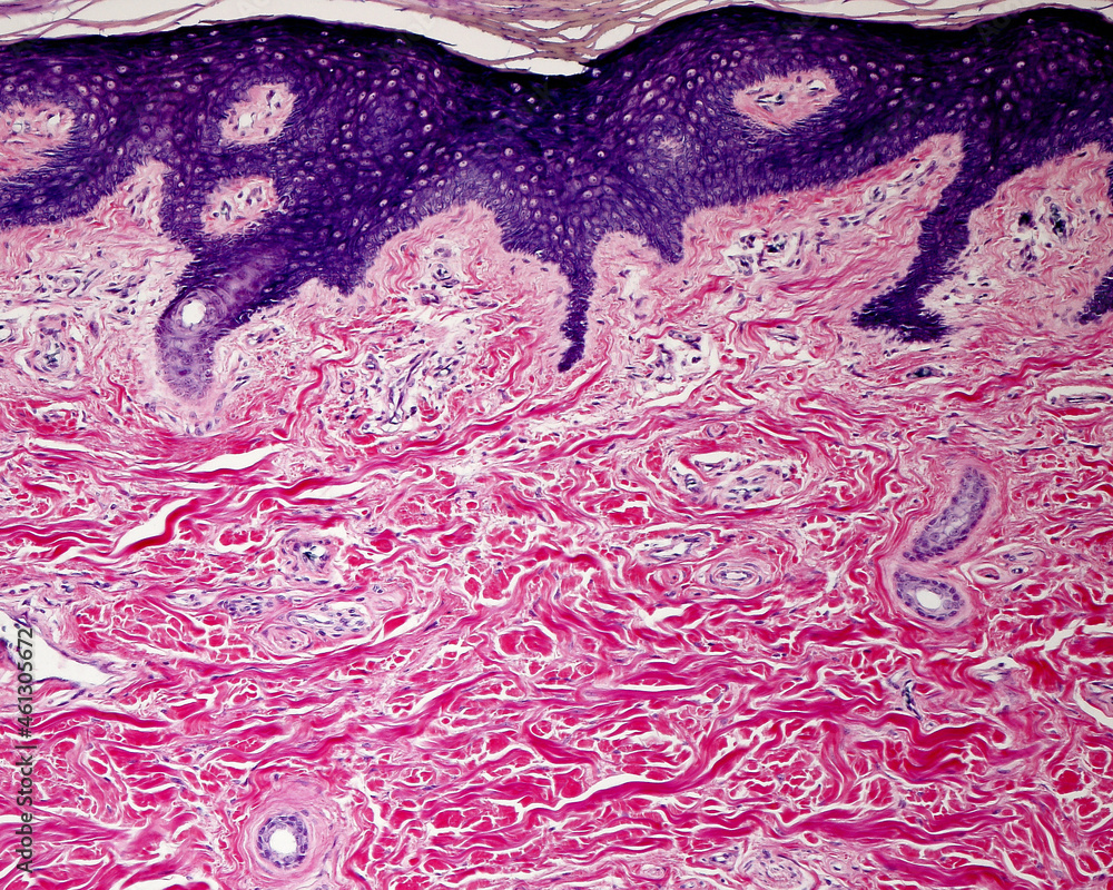 Dermis. Mallory PTAH stain Stock Photo | Adobe Stock