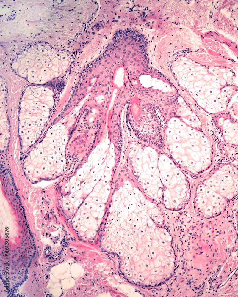 Pilosebaceous unit. Sebaceous gland Stock Photo | Adobe Stock