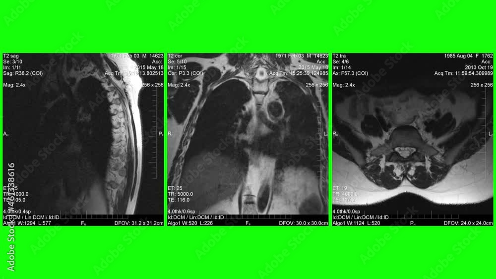 MRI , Magnetic resonance images of human body parts, green background ...