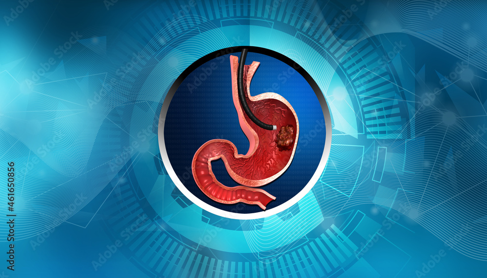 Stomach endoscopy on digital technology background. 3d illustration ...