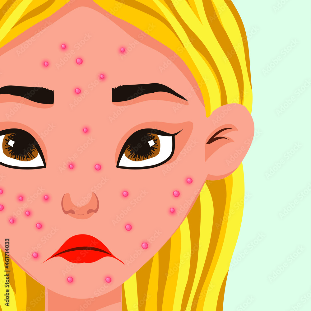Cute cartoon girl taking care of her acne prone skin. Skincare routine ...