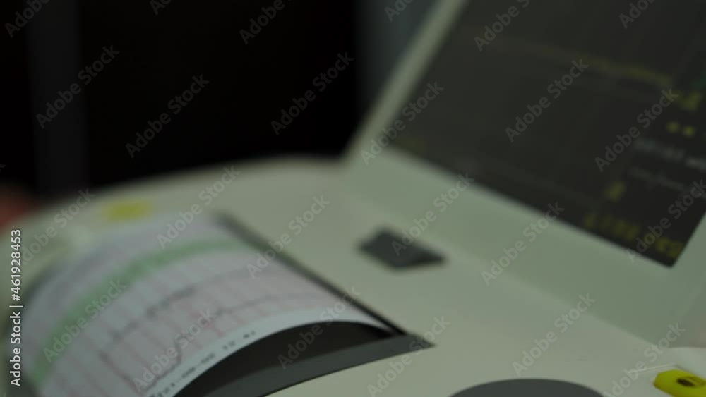 Electronic Cardiotocography Machine Monitoring Fetal Heart Contractions ...