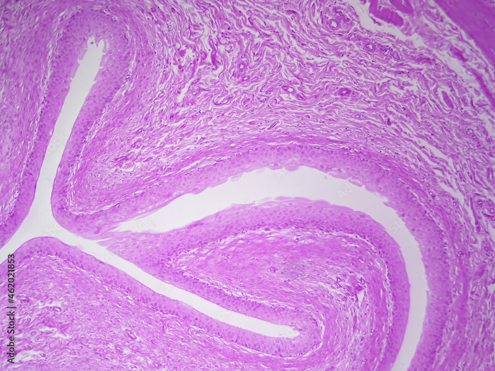 Microscope histology image of transitional epithelial of urinary ...