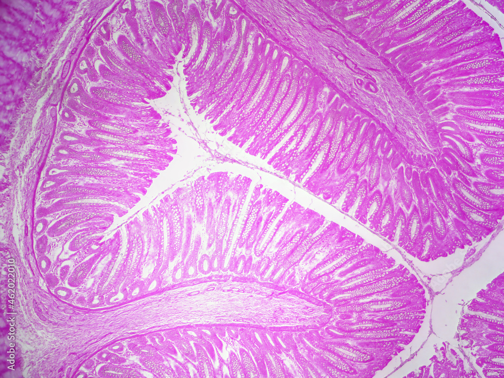 Microscope histology image of mucosal epithelial tissue of the rectum ...