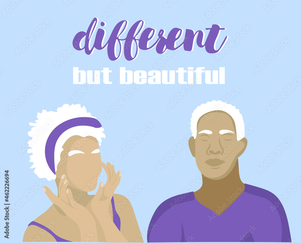 Man and woman with albinism. Body positive concept. International ...