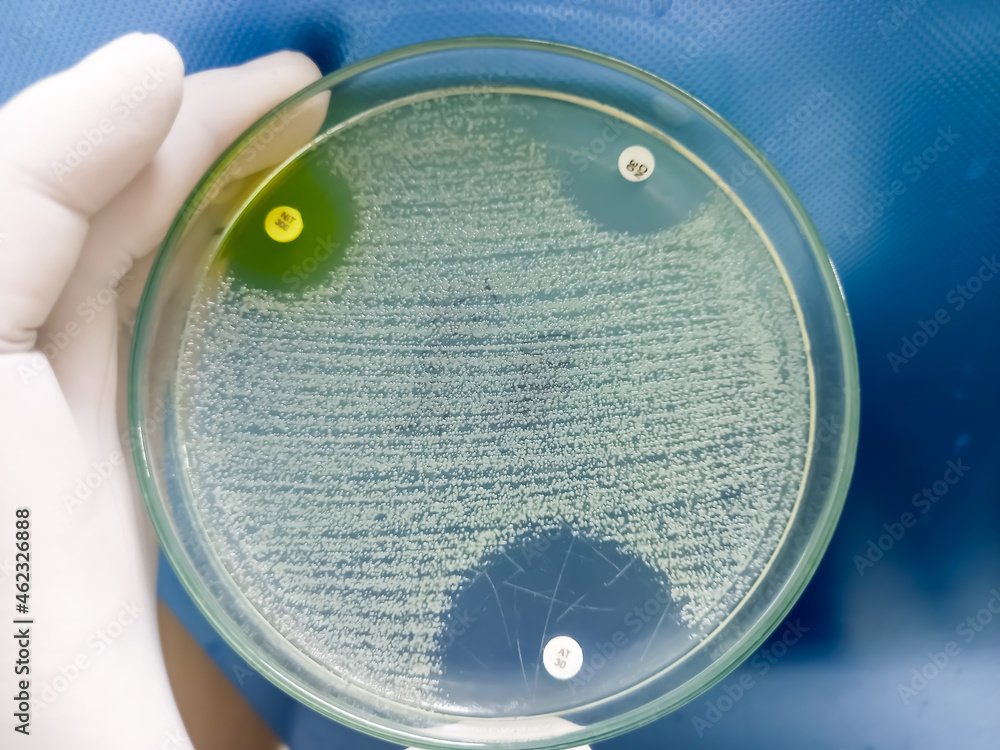 Antimicrobial susceptibility testing in culture plate. Drug sensitivity ...