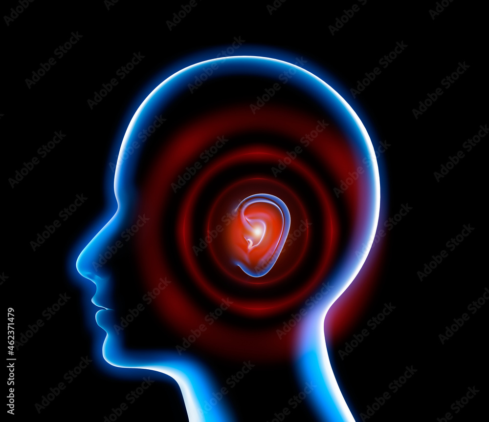 Blue head with ear pain or tinnitus - 3D illustration Stock ...