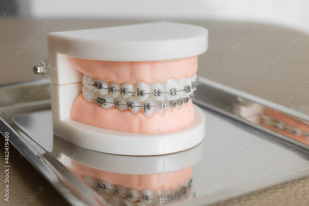 orthodontic model and dentist tool - demonstration teeth model of ...