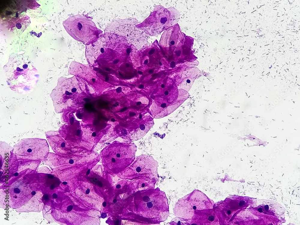 Microscopic view of normal human cervix cells. Squamous epithelium ...