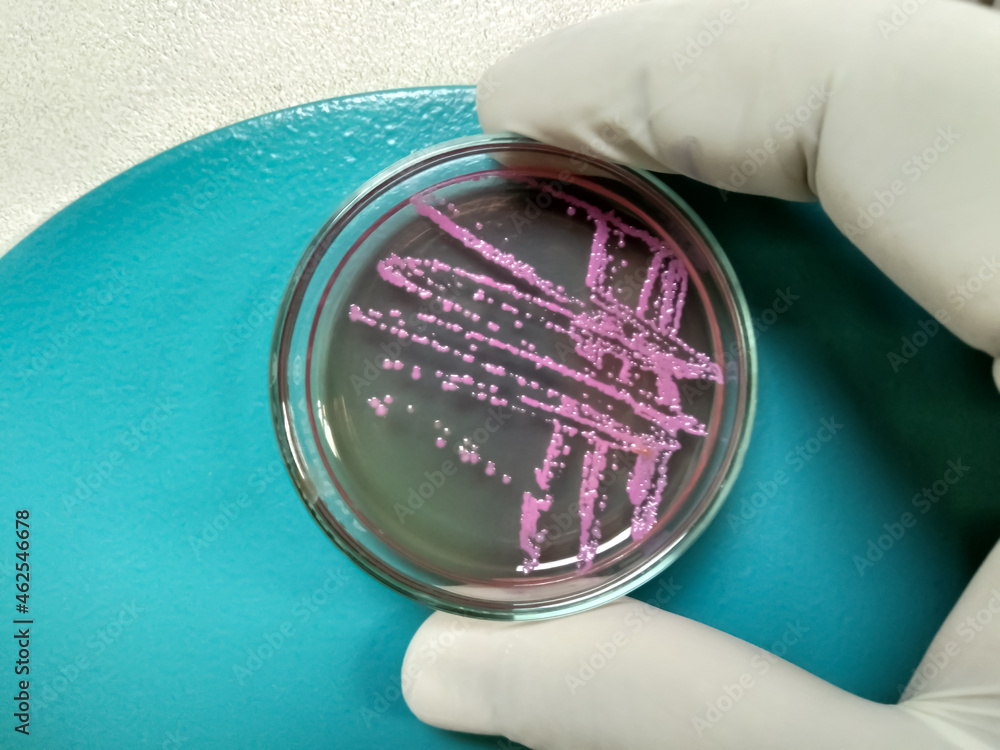 Bacteria colonies culture on selective agar media(SS agar) contains ...
