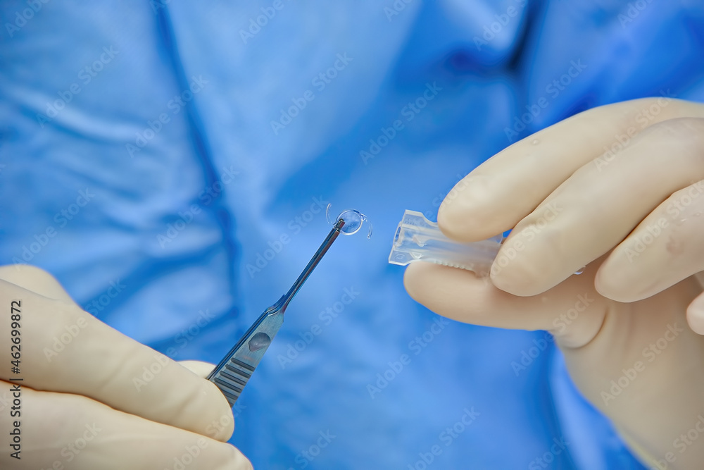 iol intraocular lens cataract ophthalmology Stock Photo | Adobe Stock