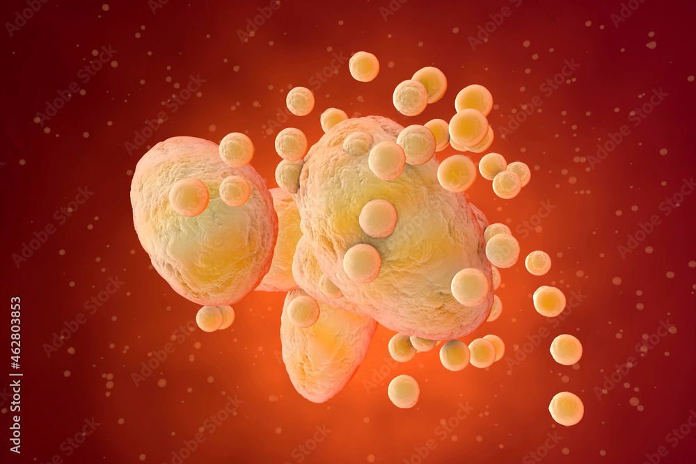 3D Rendered Illustration, visualisation of fat cells clogging together ...