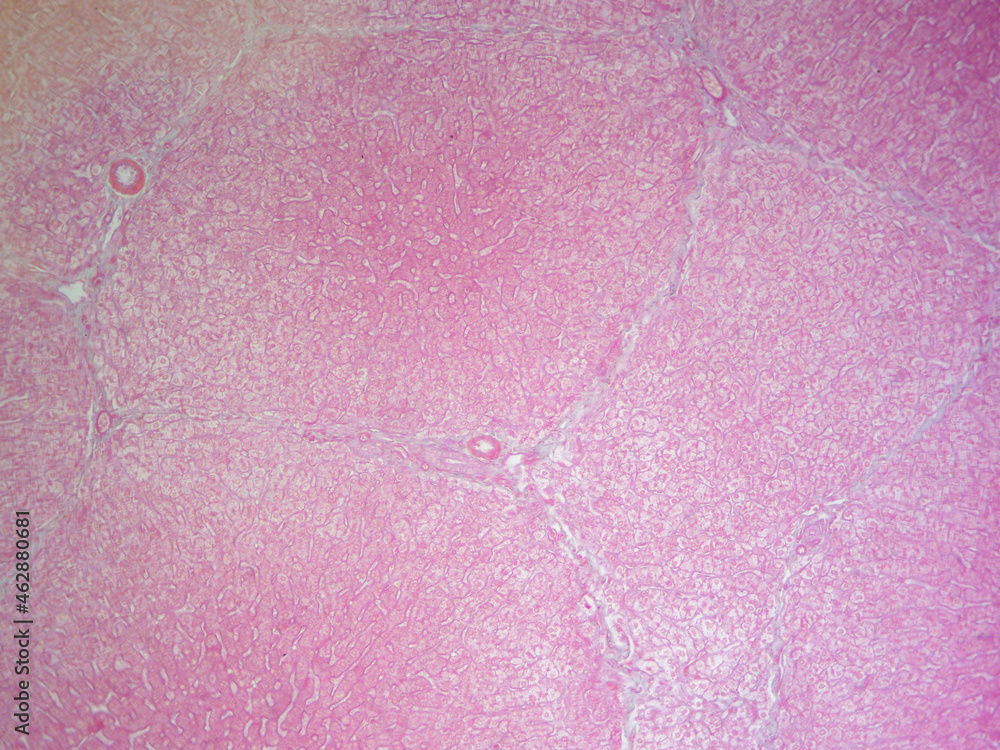 Histology microscope image of the liver (40x) Stock Photo | Adobe Stock