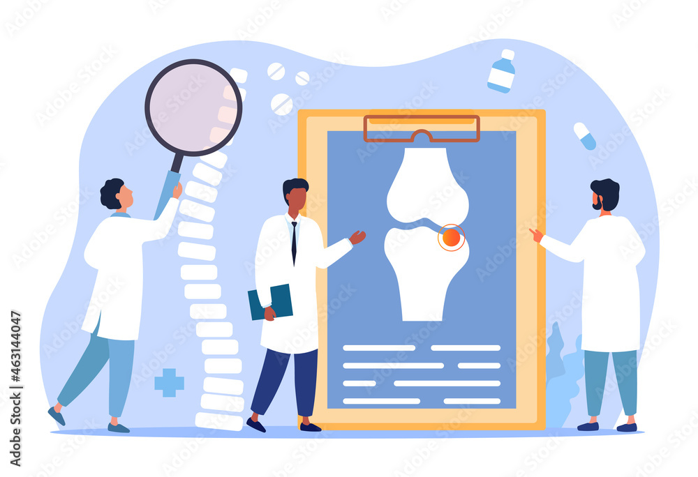 Osteoporosis concept. Doctors examine the spine and other bones of the ...